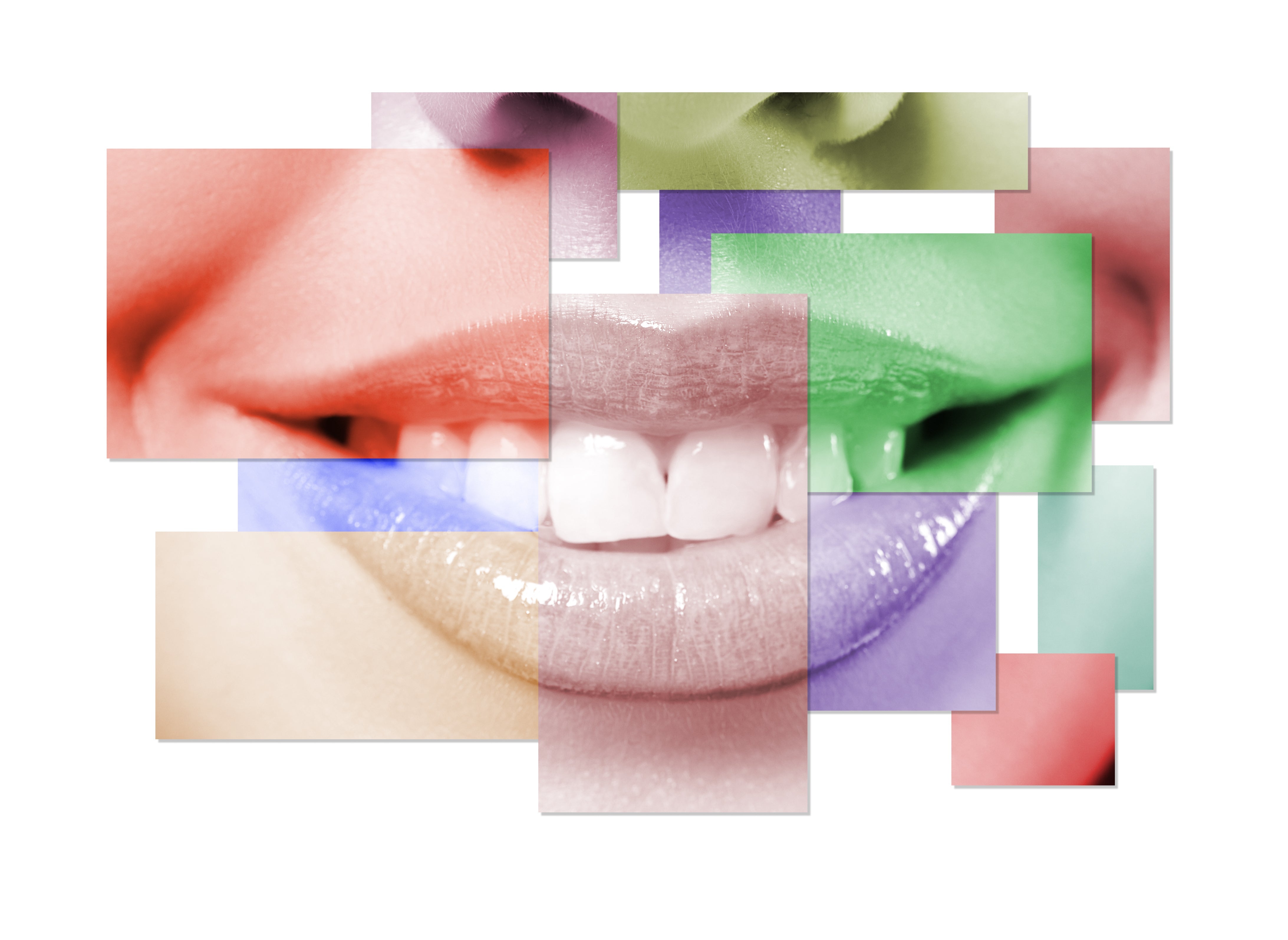 How Teeth Whitening Can Enhance Your Smile Before Bonding or Veneers ...